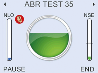 Otoport OAE+ABR Upgrade